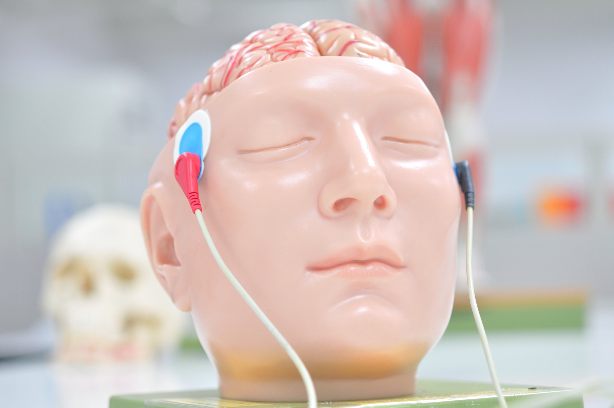 New Deep Brain Stimulation Method Enhances Brain Excitability Improves