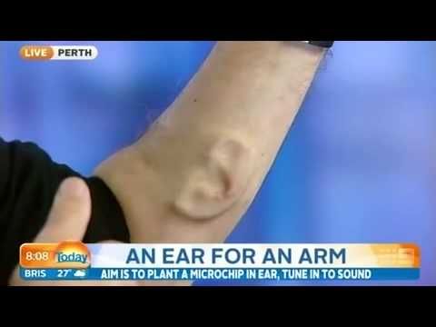 Australian Artist Stelarc Has Had A 3rd Ear Growing On His Left Arm For ...