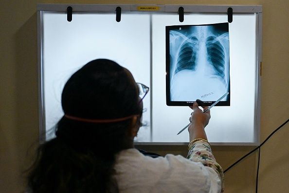 Washington Records ‘Largest’ TB Outbreak In 20 Years